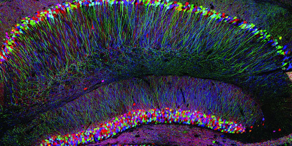 Brainbow Hippocampus